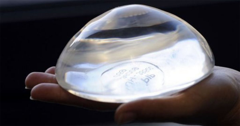 Augmentation mammaire bonnet C : implant ou transfert de graisse