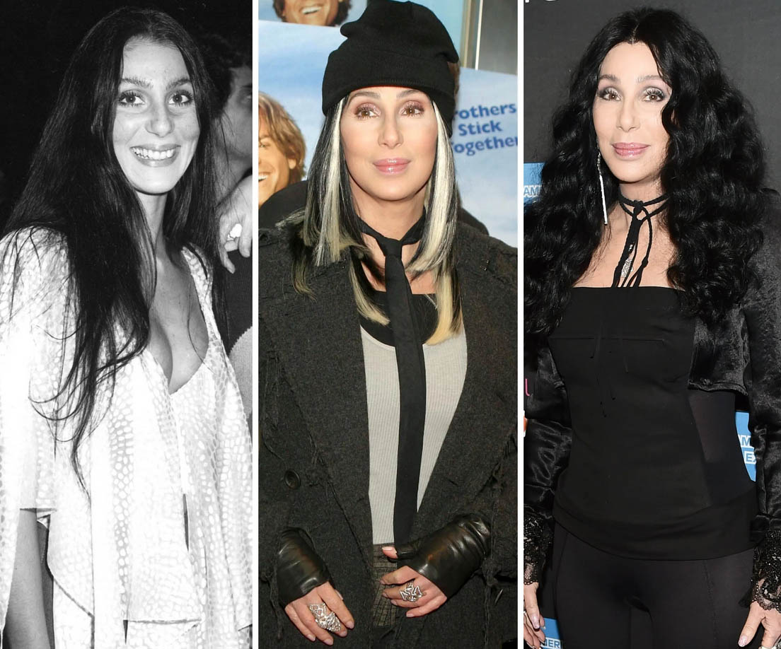 Chirurgie esthétique de Cher : l'incroyable transformation de la star ...
